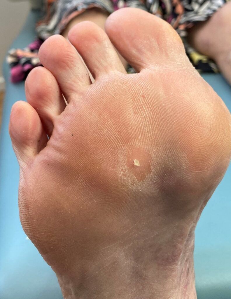 seed corn on foot uk